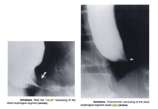 Medicine Decoded: Eponymous Signs in ENT